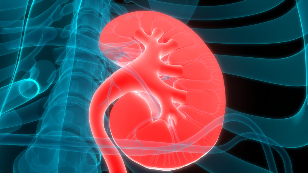 Kidney Disease Doctor in Miami - Miami Kidney Specialist